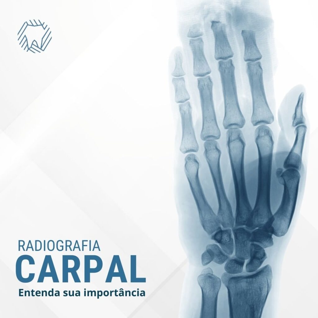 RADIOGRAFIA CARPAL: ENTENDA SUA IMPORTÂNCIA - Studio RX