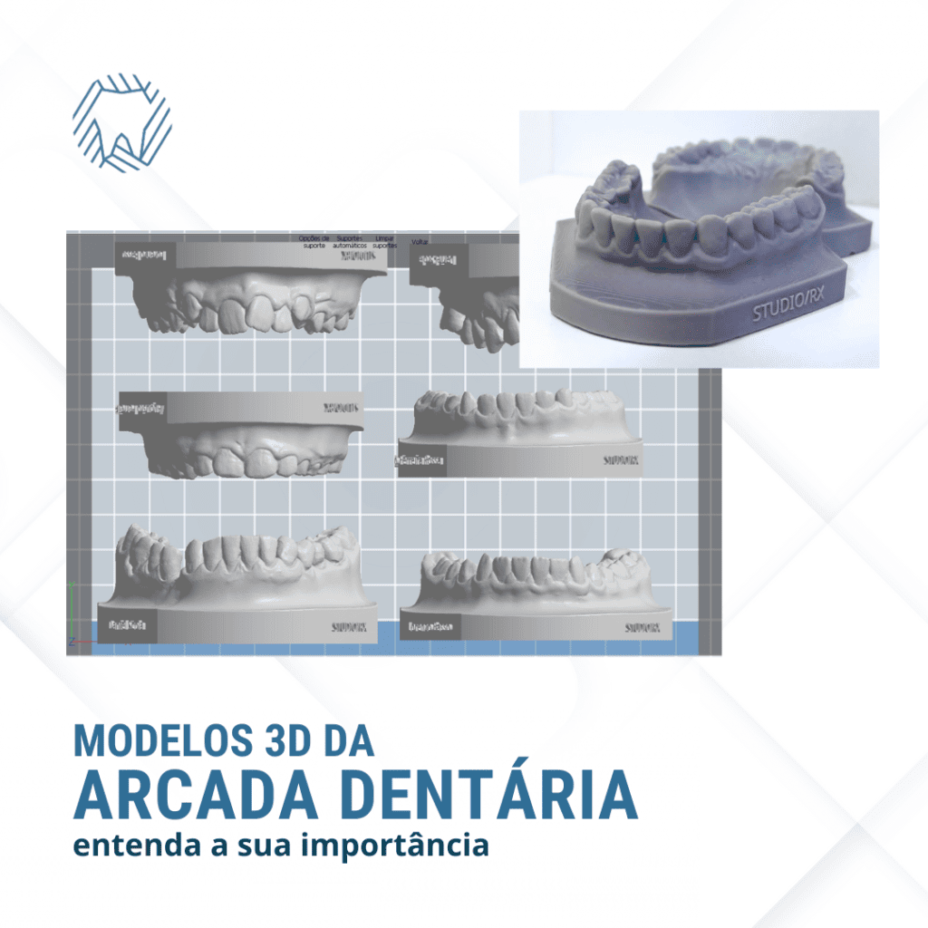Modelos 3D da Arcada Dentária - Entenda sua Importância - Studio RX