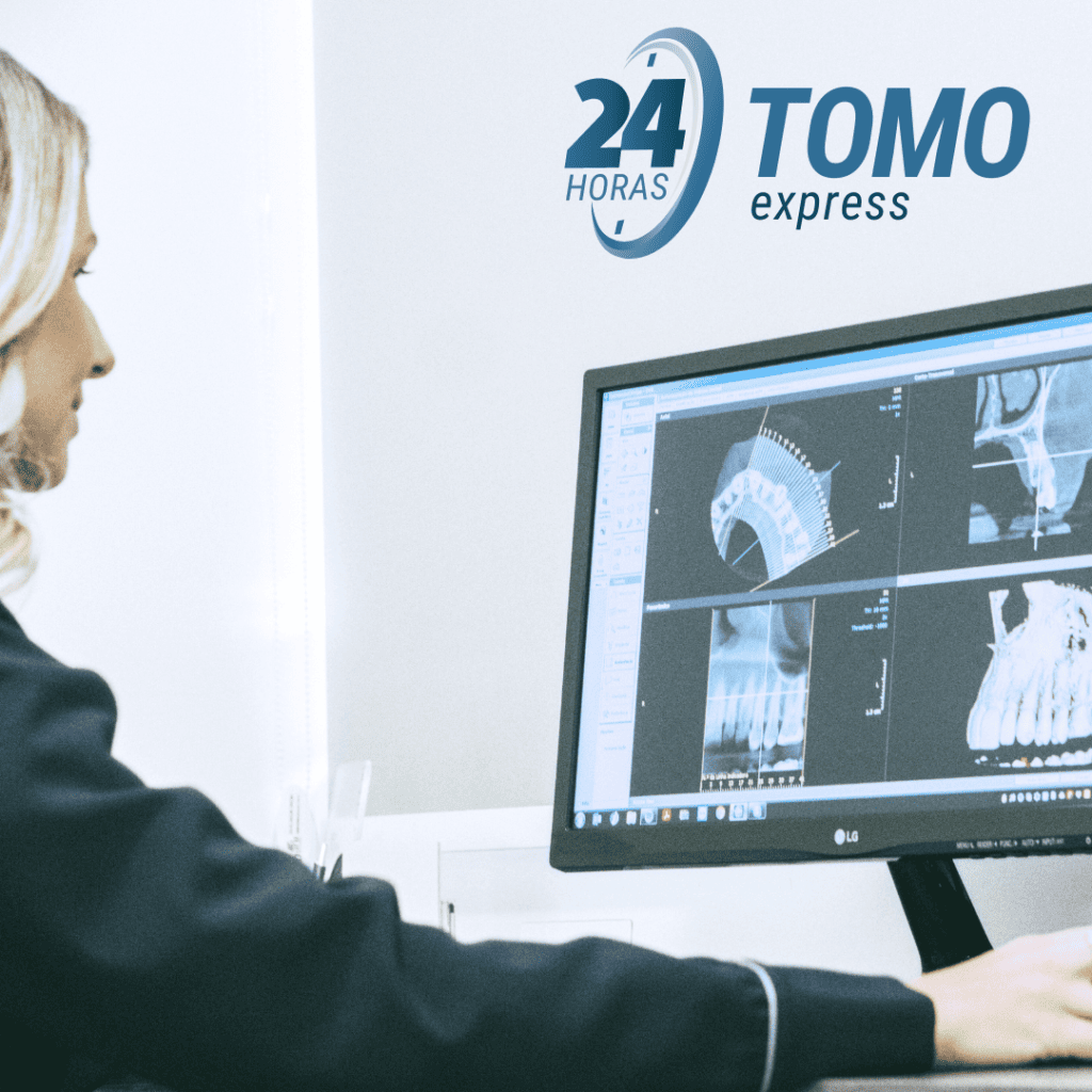 Tomo Express - Studio RX